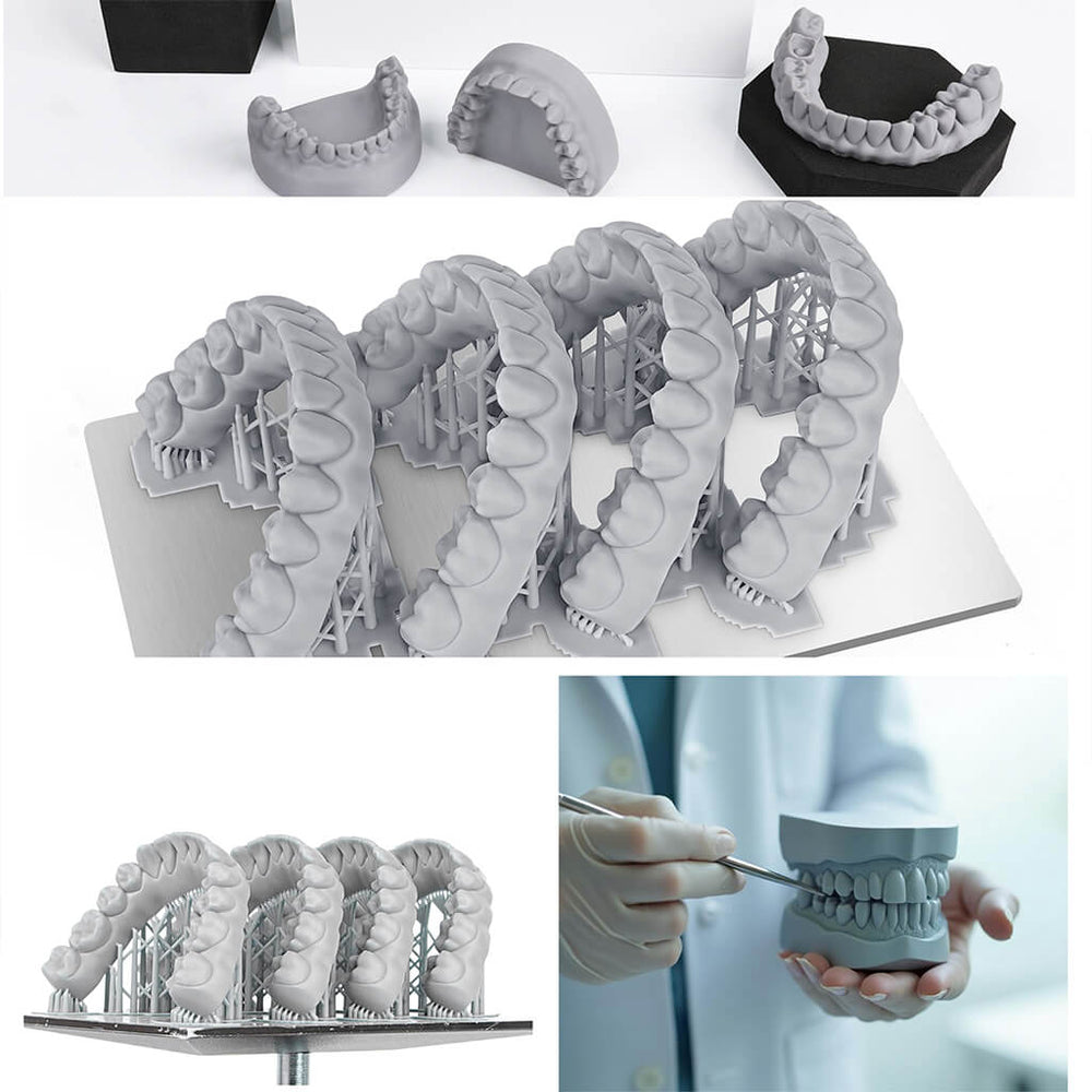 Dental Model Resin Professional 3D Printer Material - Inslogic 3D
